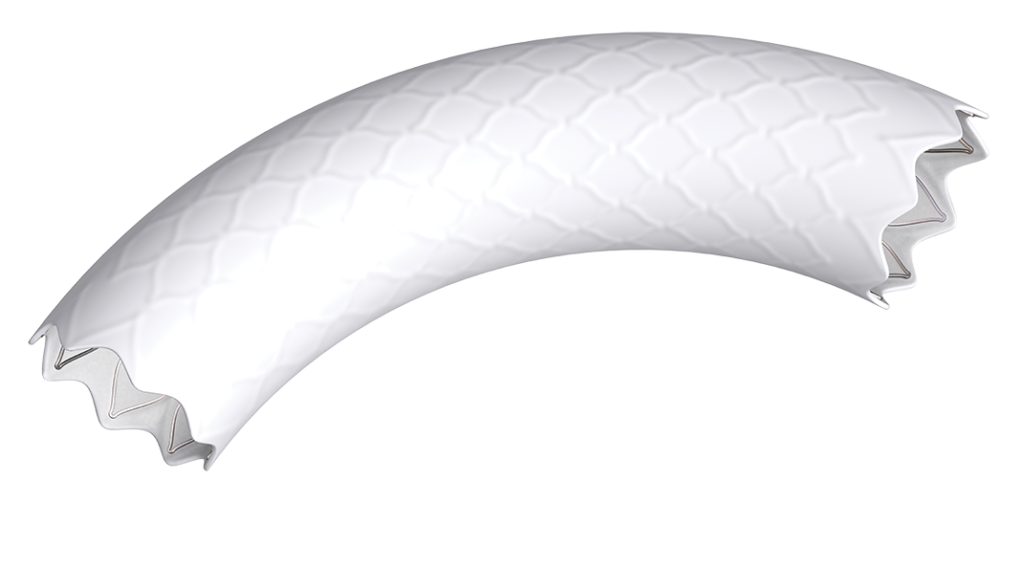 BeGraft Peripheral Stents | Ariss Medical